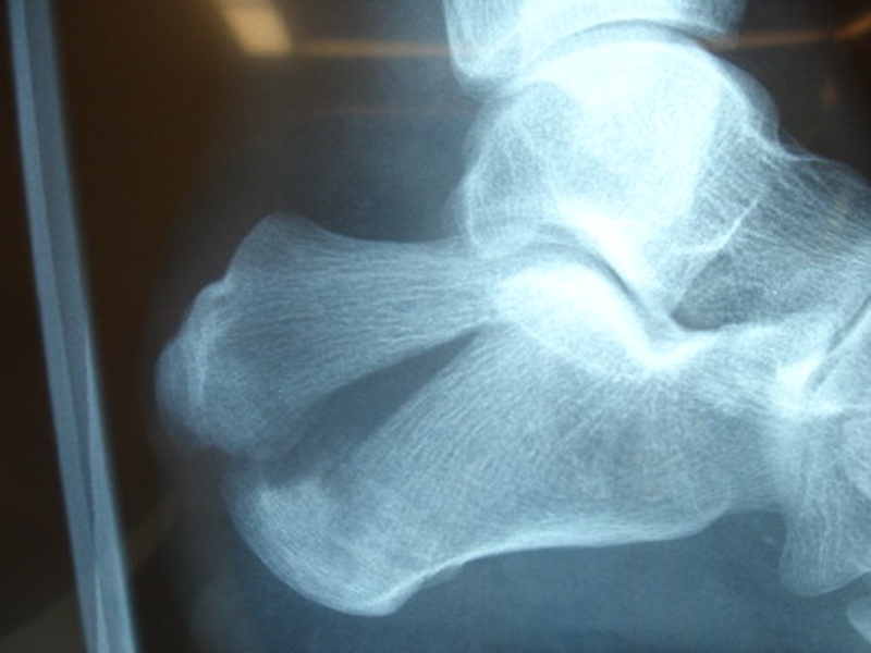 Short Bones: The Complete List - 33Science