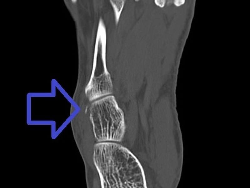 Short Bones: The Complete List - 33Science