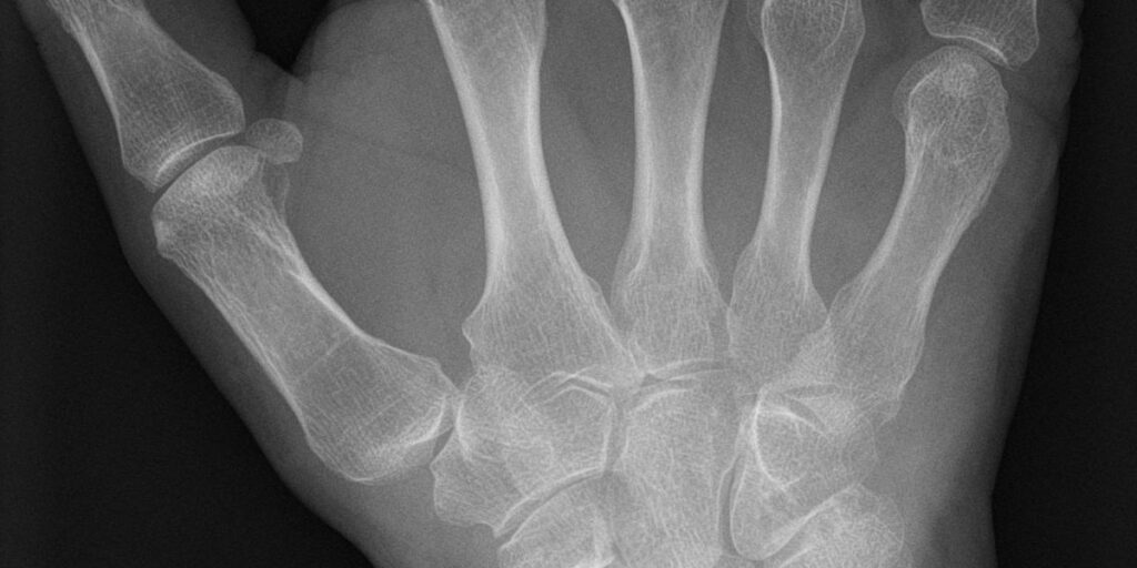 Short Bones: The Complete List - 33Science