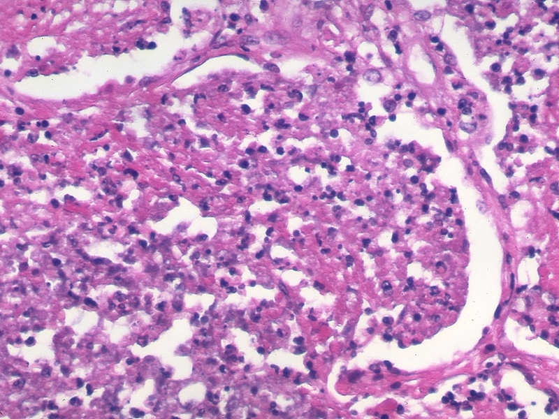 Types of Inflammation: The Complete List - 33Science