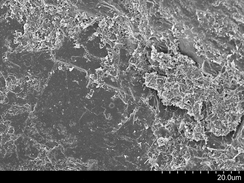 Types of Microbial Growth: The Complete List - 33Science
