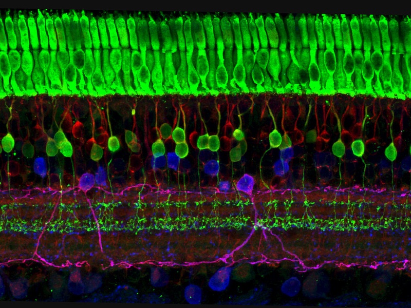 Examples of Neurons: The Complete List - 33Science