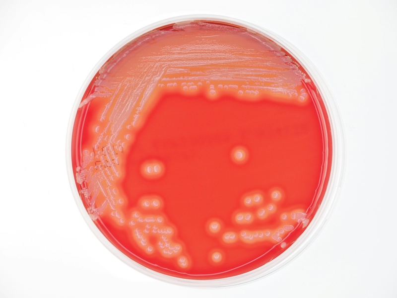 List of Pathogenic Bacteria - 33Science