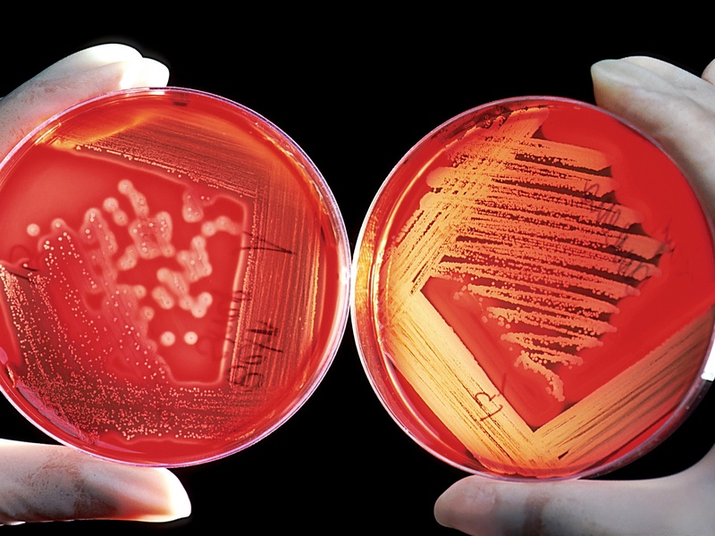 Types of Microbial Growth: The Complete List - 33Science