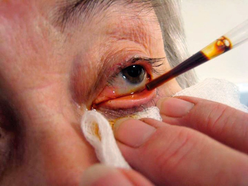 Examples of Antiseptics: The Complete List - 33Science