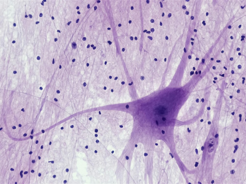 Examples of Neurons: The Complete List - 33Science